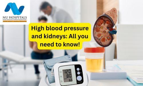 Intravenous Urography (IVU) Test in Bangalore | NU Hospitals