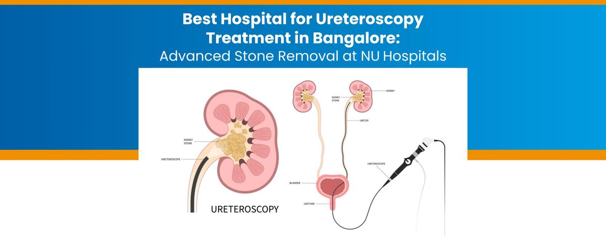 ureteroscopy nhs