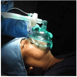 Complete Guide to Urethral Stricture Surgery and Recovery: DVIU ...