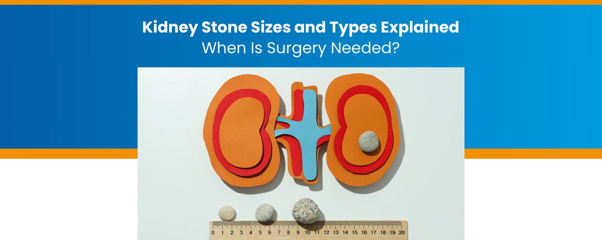 Kidney Stone Types, Size, & Surgery Guide | NU Hospitals
