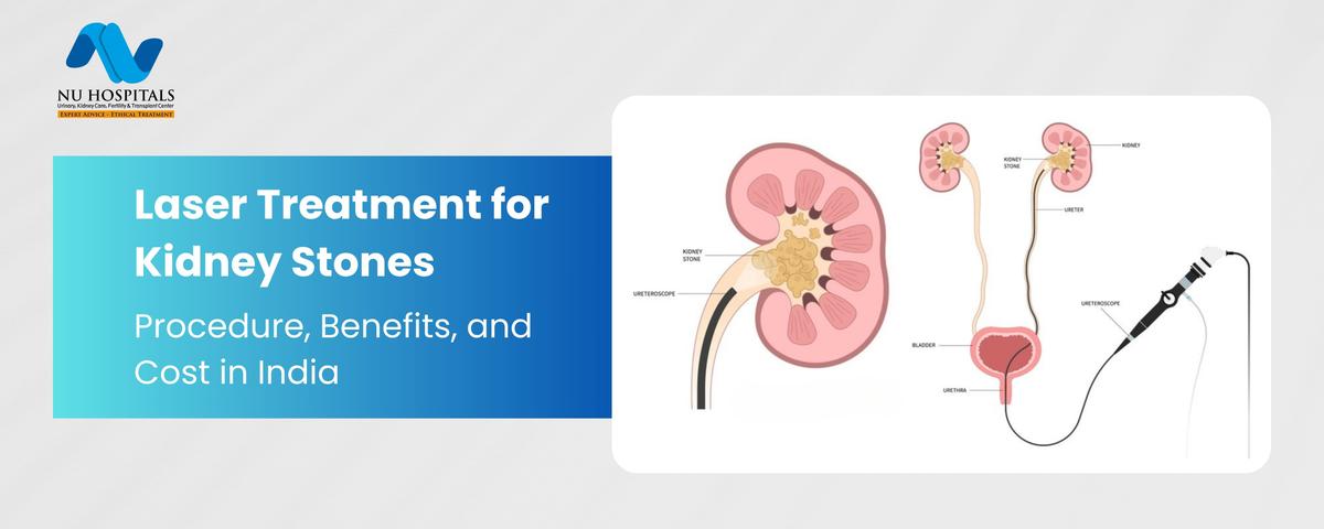 lithotripsy procedure steps