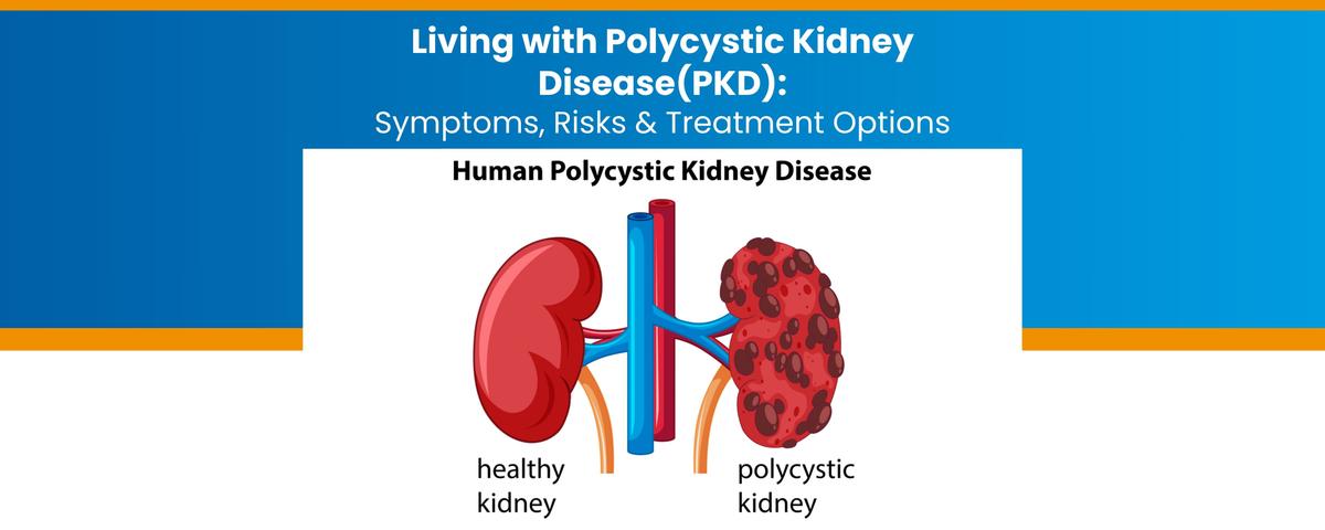 polycystic kidney disease causes