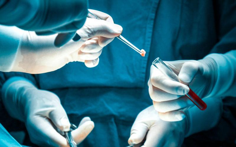 renal-biopsy-purpose-procedure-and-risks